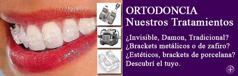 Ortodoncia invisible, brackets de zafiro, metalicos, porcelana, sistema damon, tratamientos ...