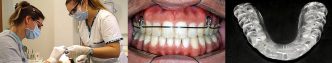Contención y Retiro de brackets, tipos de ortodoncia invisible, brackets de zafiro, metalicos ...