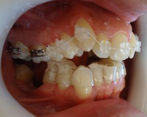 8- Vista lateral derecha del paciente | Dentistas Estetica dental ...