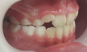 10-VISTA LATERAL DERECHO | Dentistas Estetica dental - Ortodoncia Salud